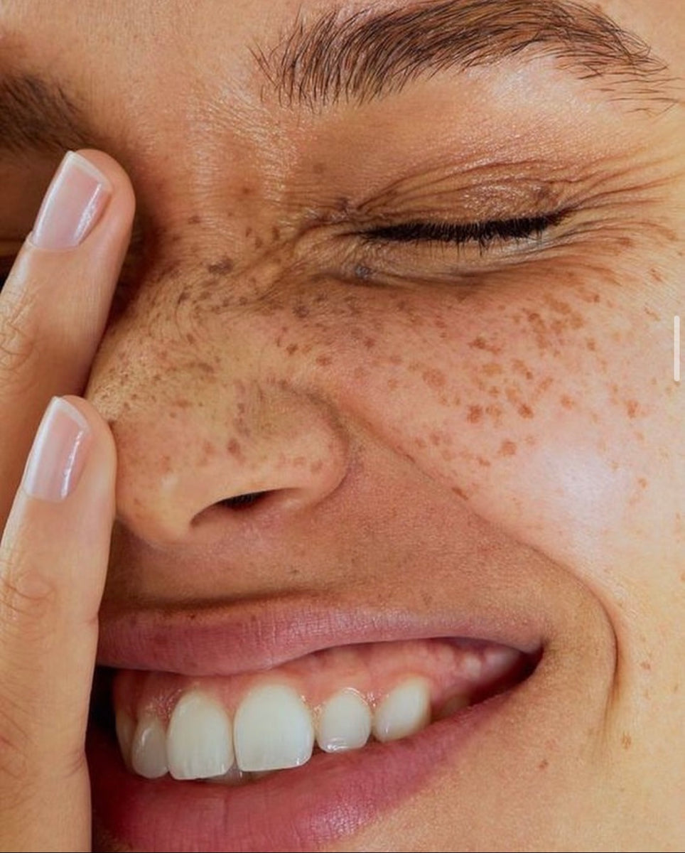 How do Free Radicals Affect Our Skin? – Active Collagen